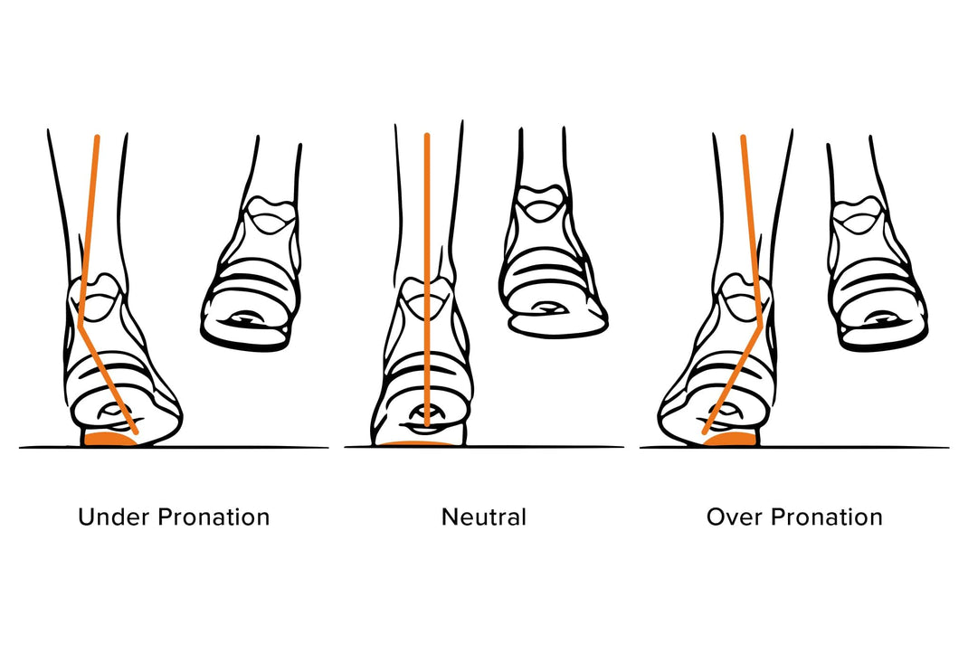 What is Gait Analysis - Everything You Need To Know – Up & Running